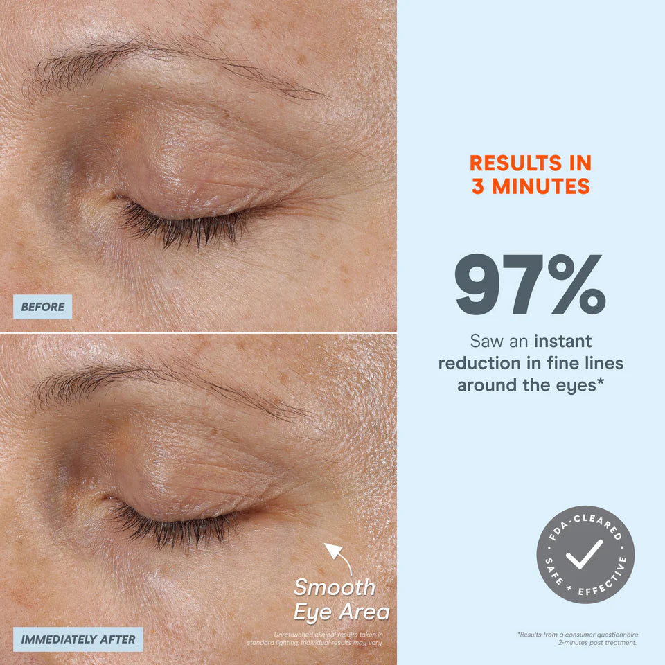NuFace Fix MicroWand – Paramount DaySpa Salon Boutique